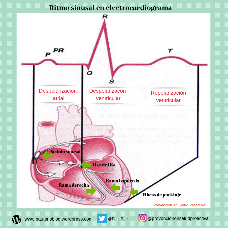 ritmo sinusal (1) | PREVENCIÓN EN SALUD PROACTIVA
